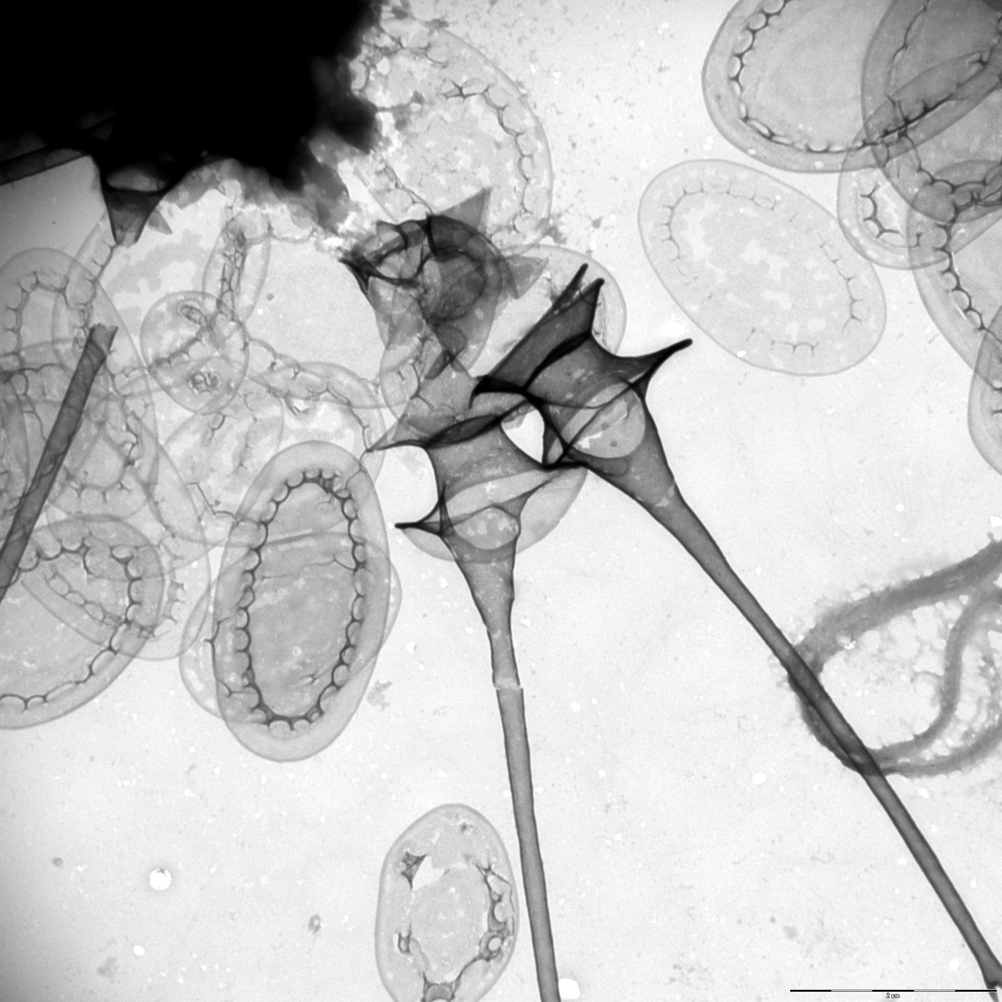 Chrysosphaerella rotundata | Silica-scaled chrysophytes of Europe